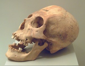 The bizarre tradition of the deformed skulls – Archaeology Mysteries
