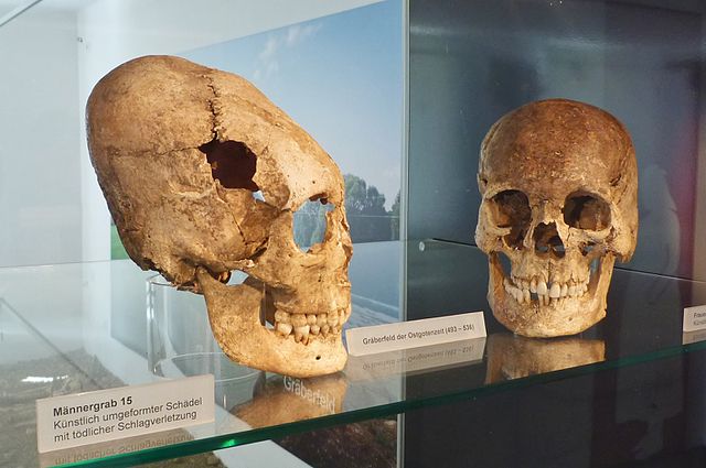 The 11 most extreme body transformation practices in history ...